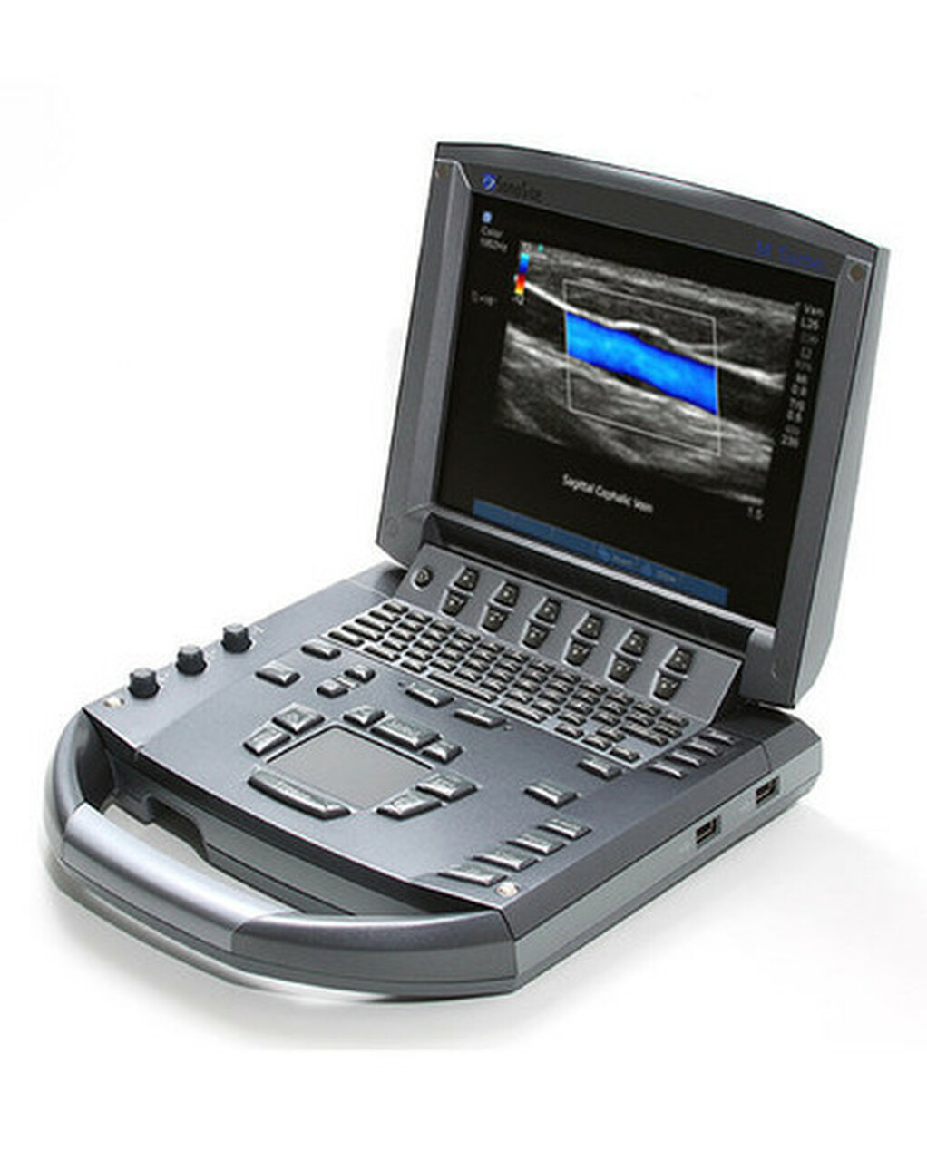 Ultrasound Machines | USME